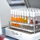 News Update – Esolate